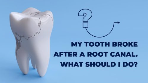 My Tooth Broke After a Root Canal. What Should I Do?