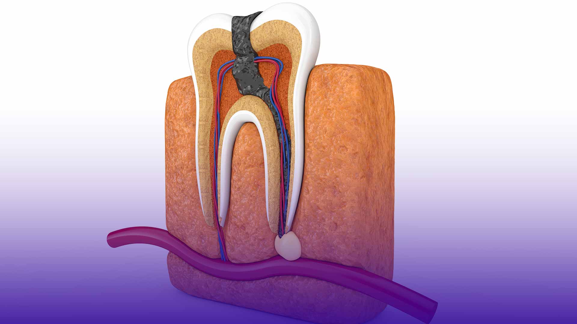 What Happens During a Root Canal Procedure? - Aliadent