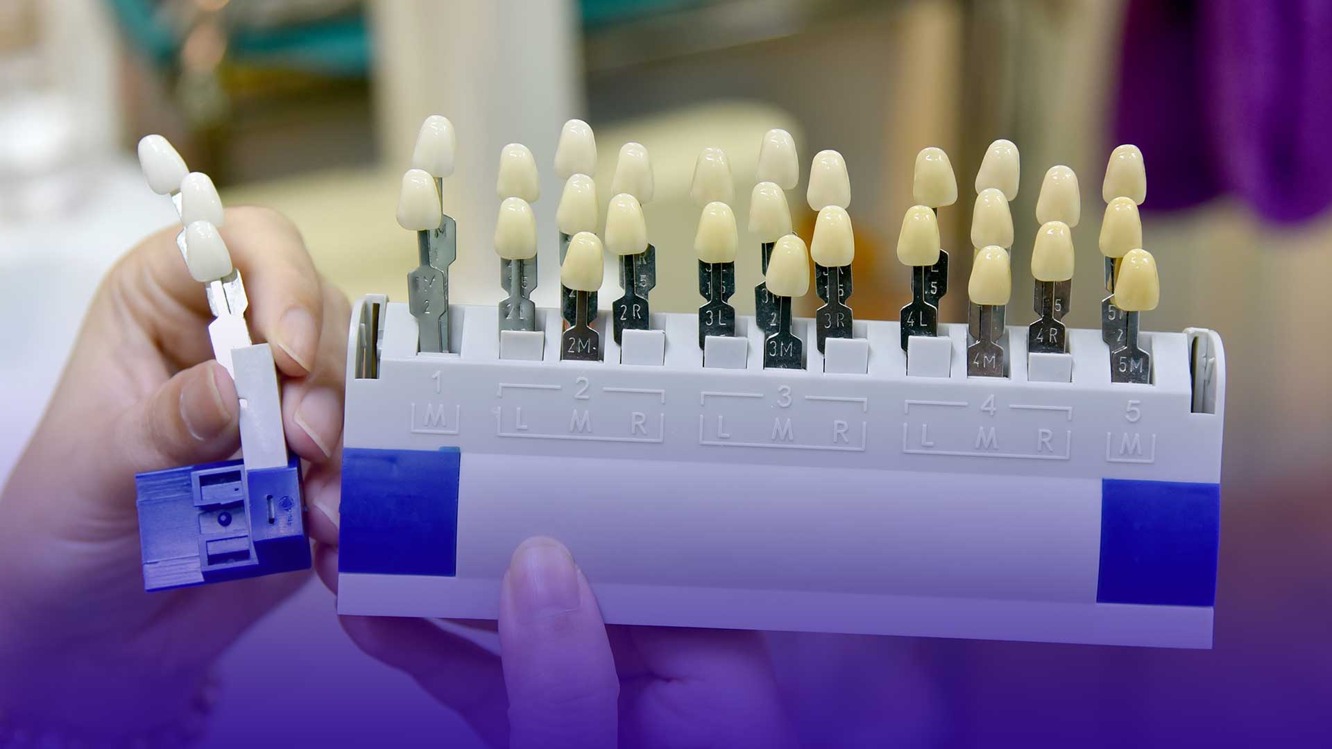 Zirconium vs. Porcelain Crowns: Which Is Best for You?