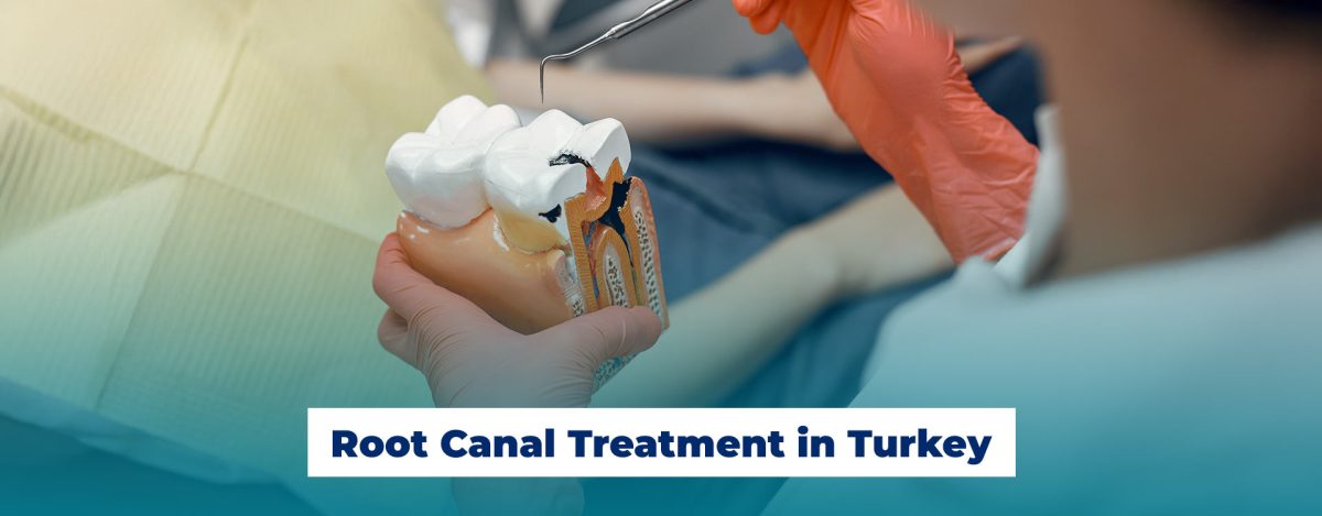 Root Canal Treatment in Turkey - Discover More with Aliadent
