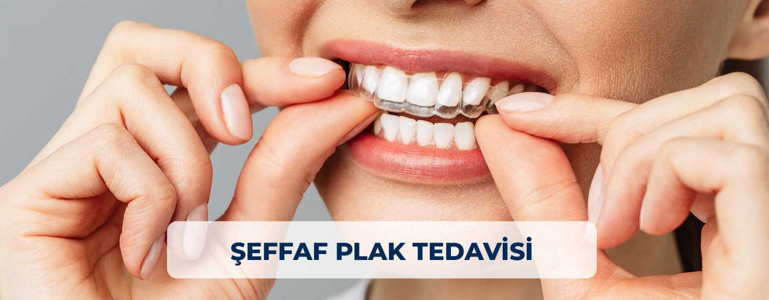 Şeffaf Plak Tedavisi - Invisalign - Aliadent Güvencesi